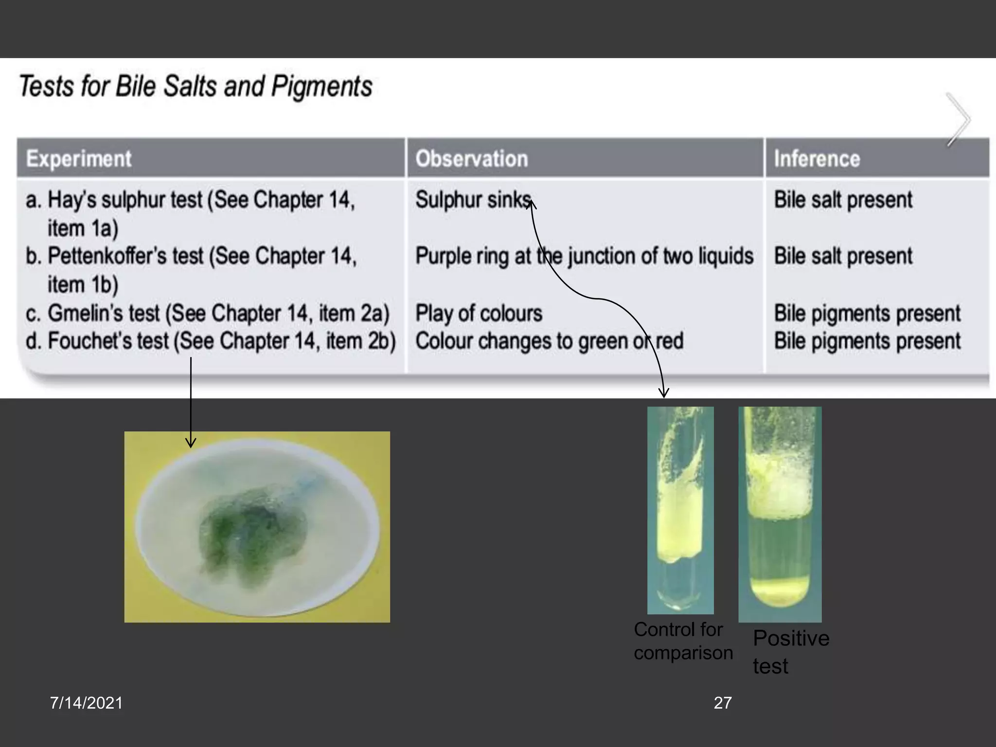 Urine analysis practical | PPTX