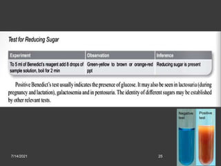 Urine analysis practical | PPTX