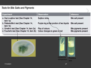Urine analysis practical | PPTX