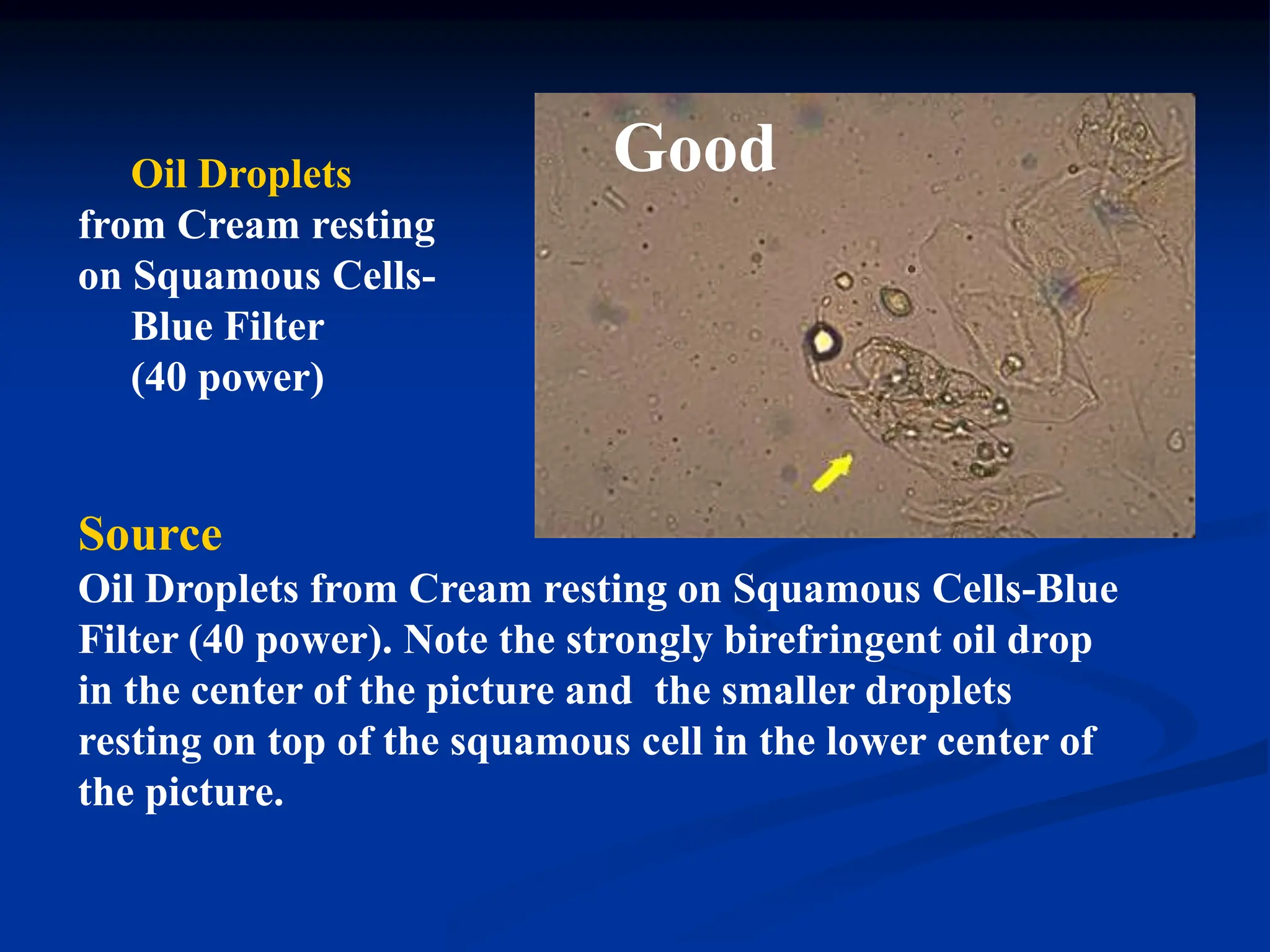 Urine and Stool analysis.ppt urine and stool analysis | PPT