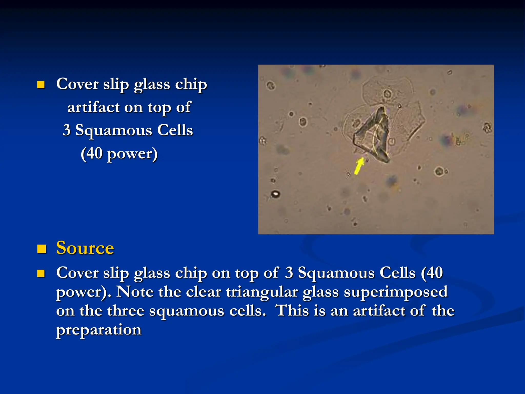 Urine and Stool analysis.ppt urine and stool analysis | PPT