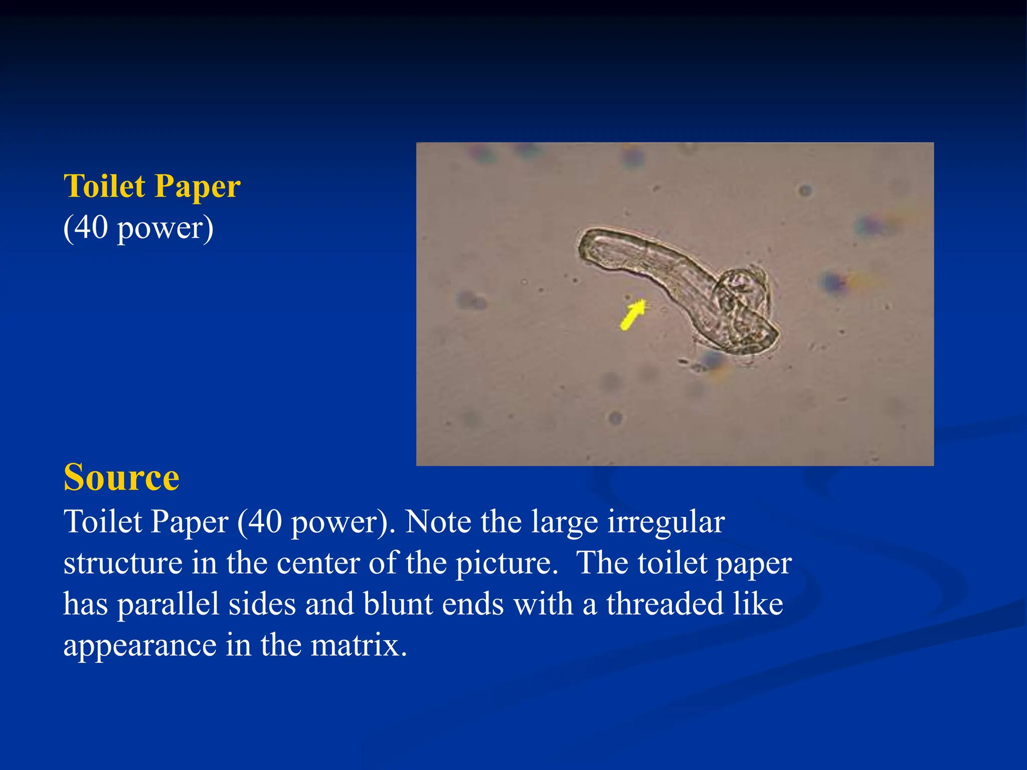 Urine and Stool analysis.ppt urine and stool analysis | PPT