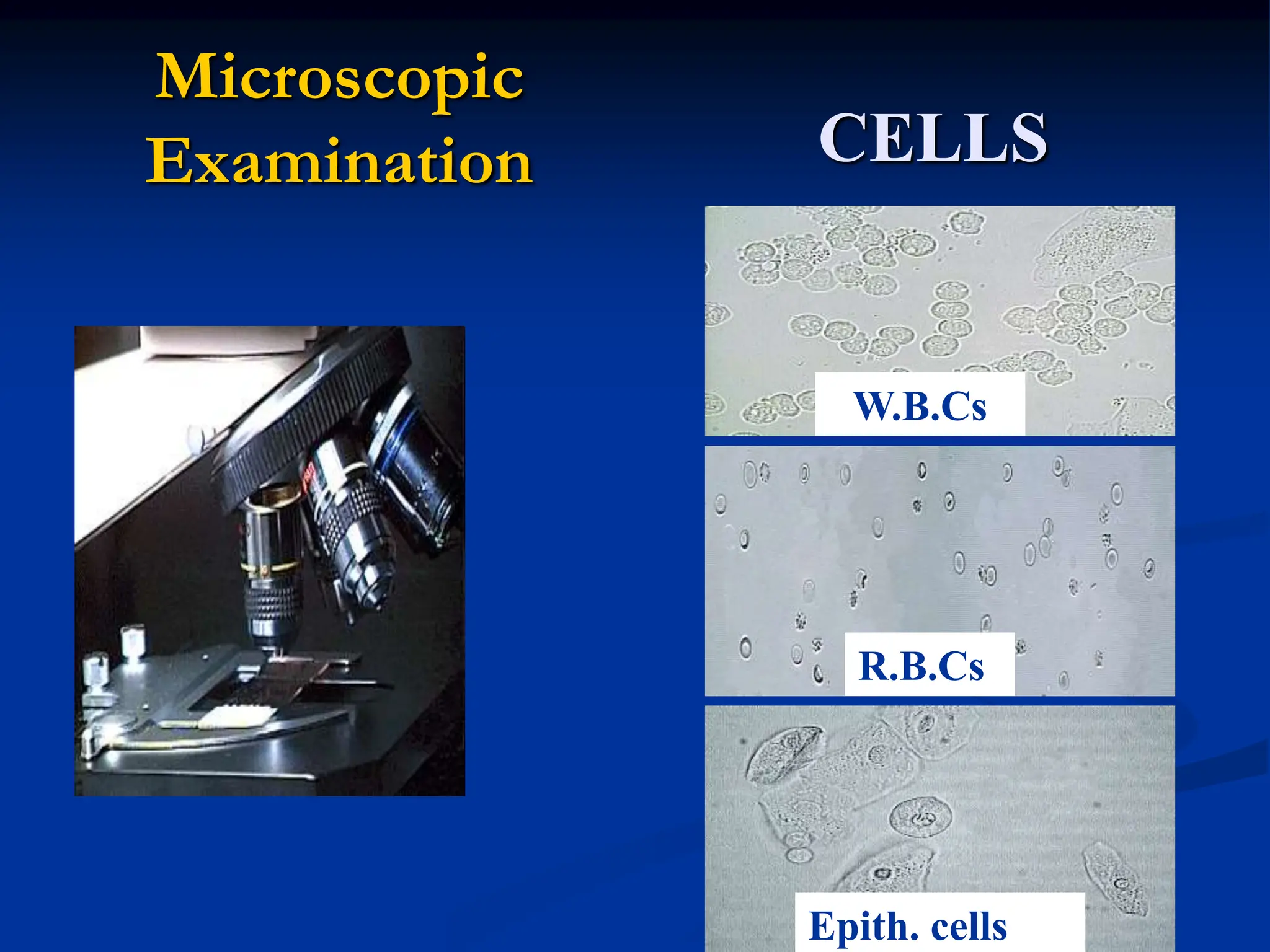 Urine and Stool analysis.ppt urine and stool analysis | PPT