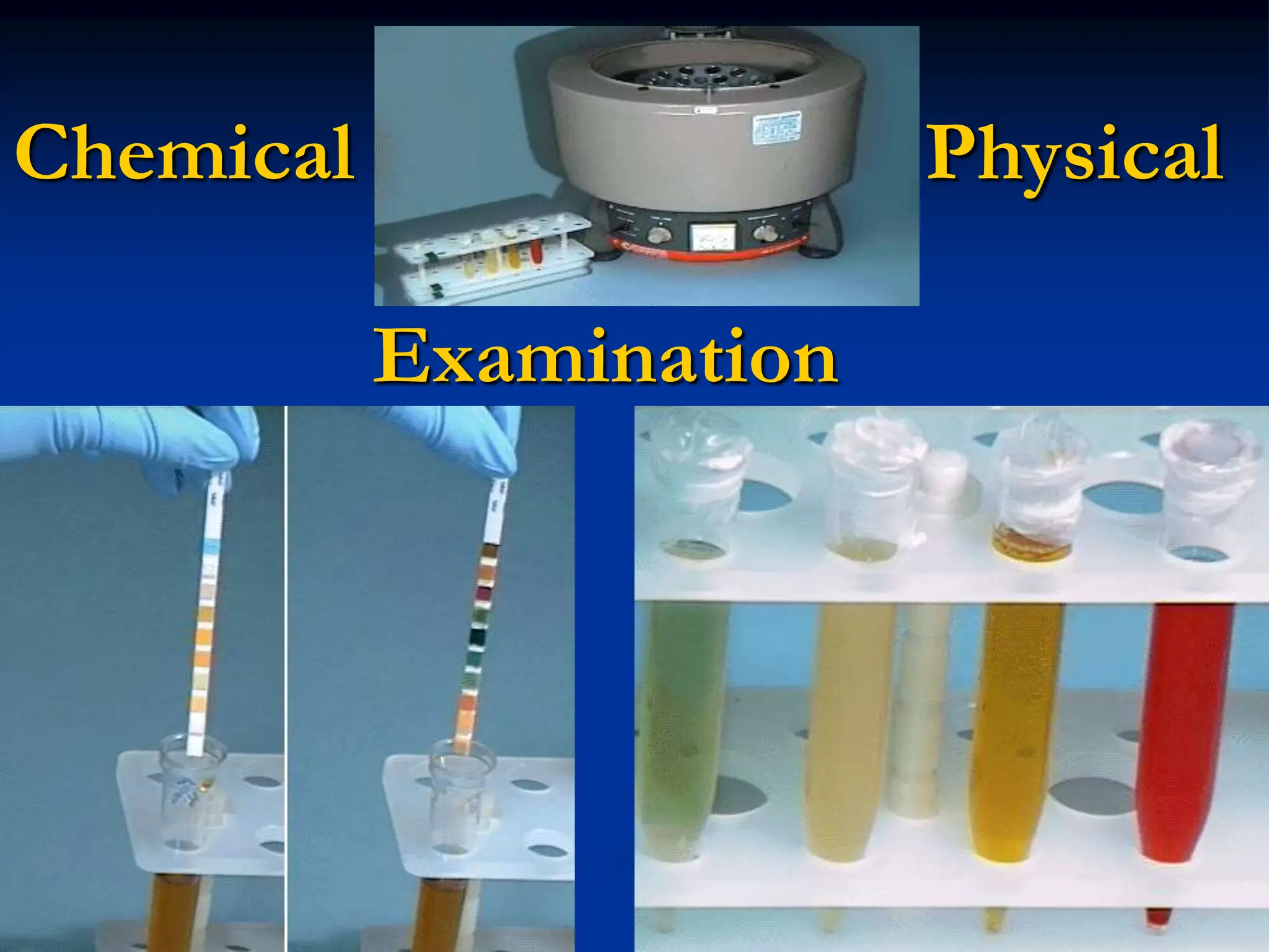 Urine and Stool analysis.ppt urine and stool analysis | PPT