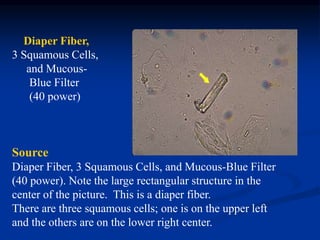 Urine and Stool analysis.ppt urine and stool analysis | PPT