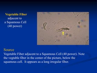 Urine and Stool analysis.ppt urine and stool analysis | PPT