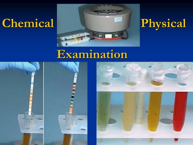 Urine and Stool analysis.ppt urine and stool analysis | PPT