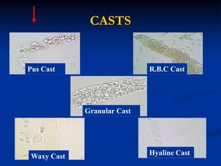 Urine and Stool analysis.ppt urine and stool analysis | PPT