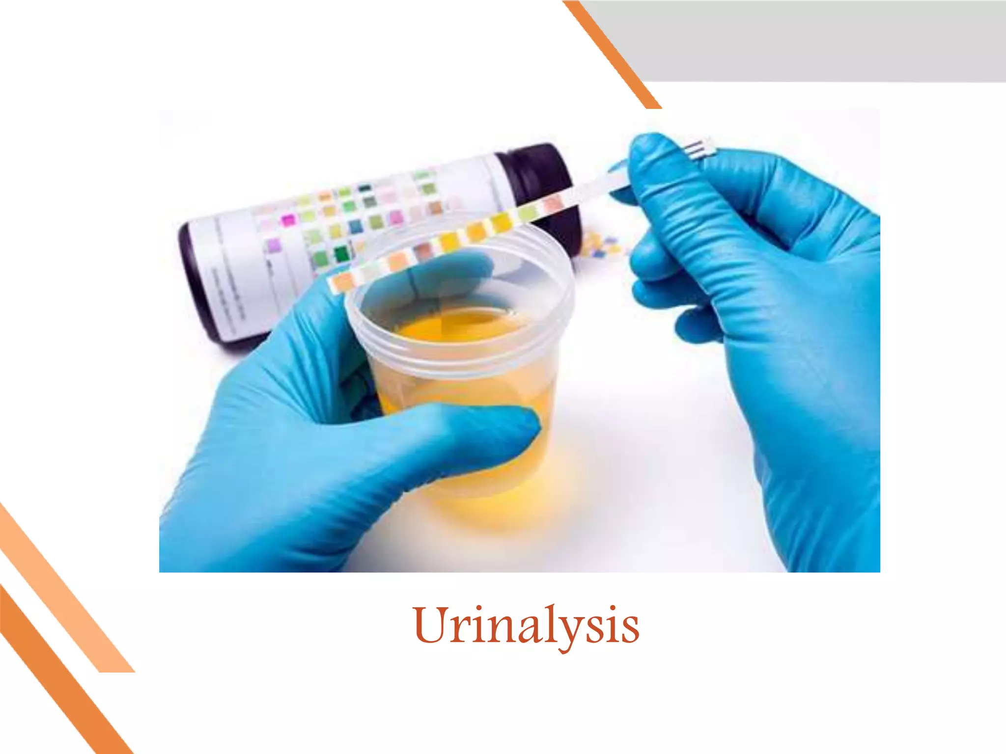 Urine and urinalysis | PPTX