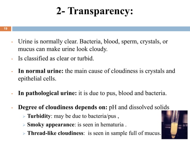 urine basics.pptx