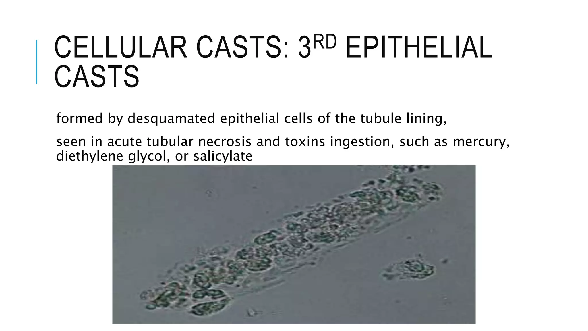 Urine casts | PPTX