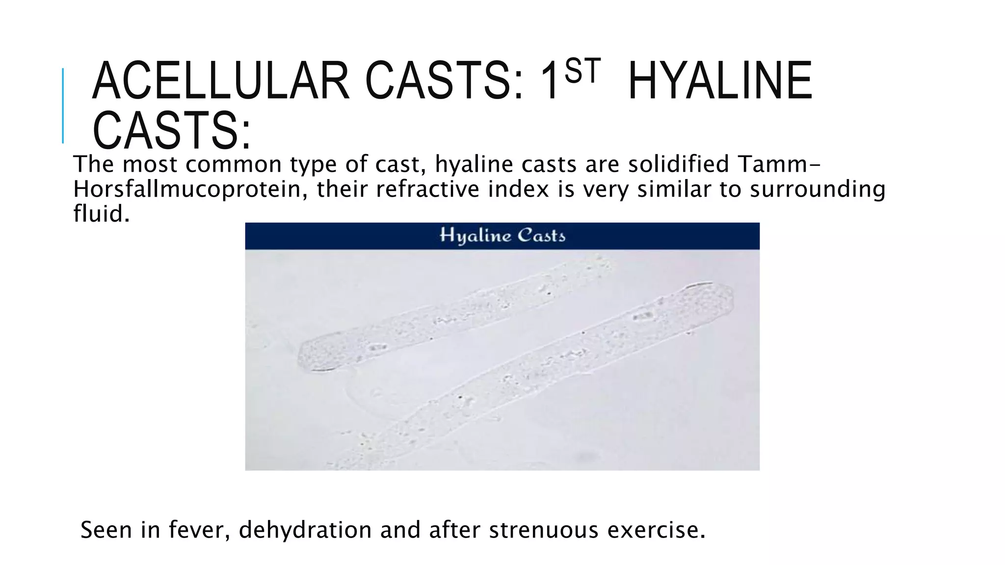 Urine casts | PPTX