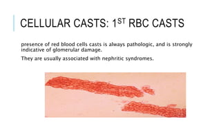 Urine casts | PPTX