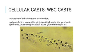 Urine casts | PPTX