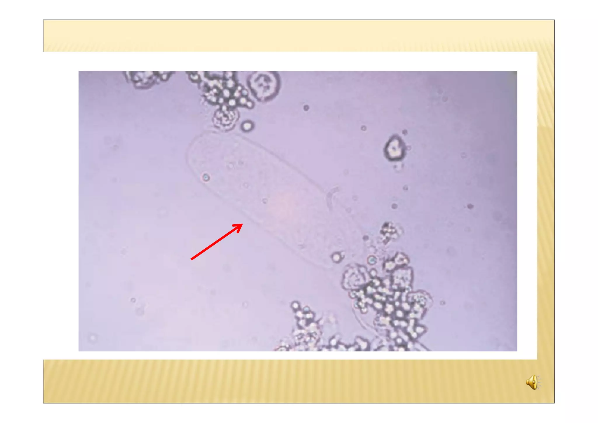 Urine casts | PDF