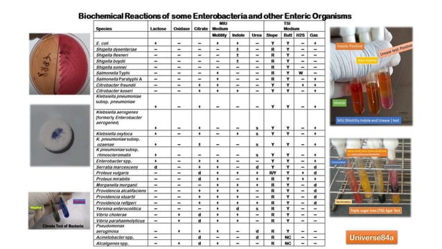 URINE culture and sensitivity.pptx