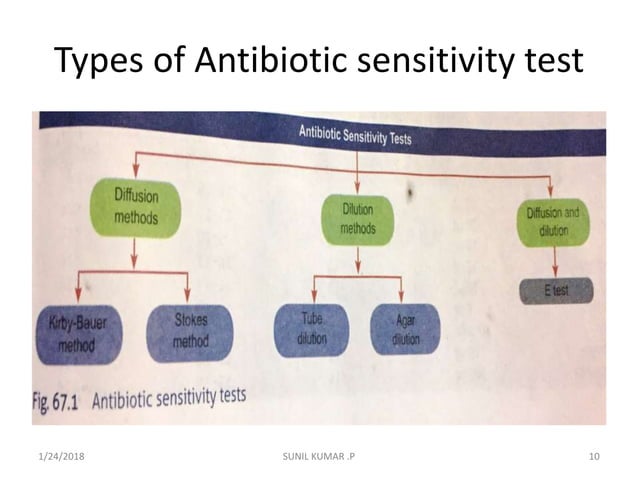 Urine culture and sensitivity | PPTX