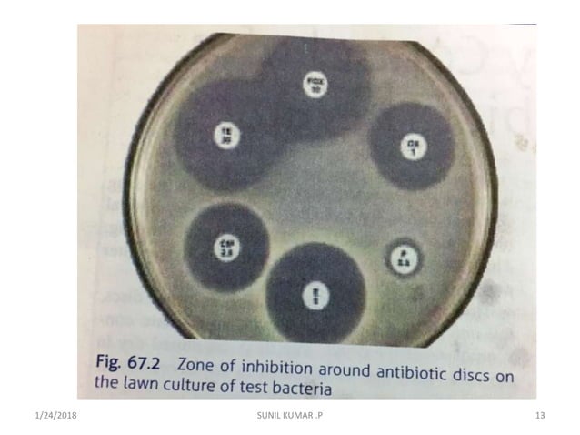 Urine culture and sensitivity | PPTX
