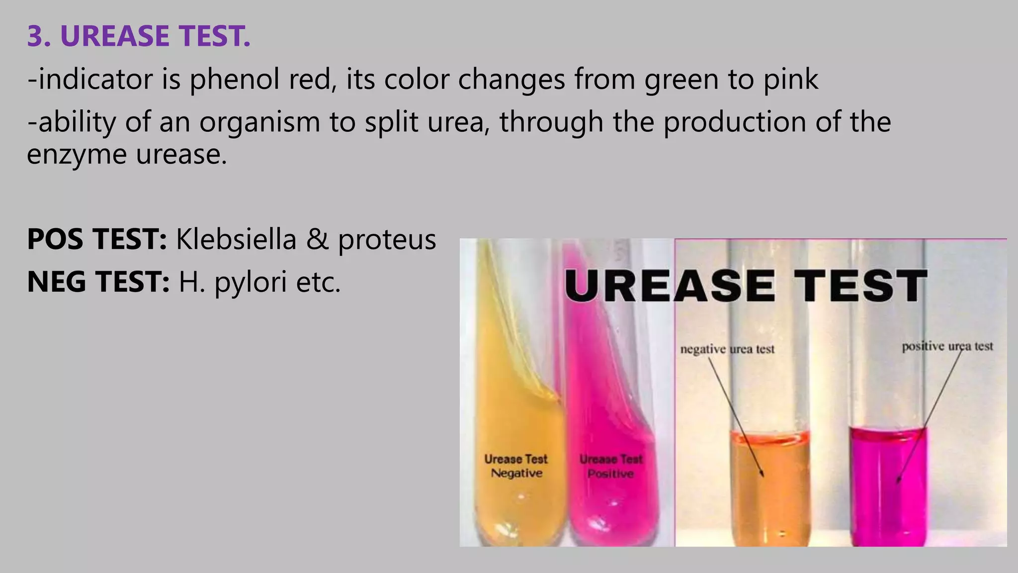 URINE CULTURE SPECIMEN.pptx