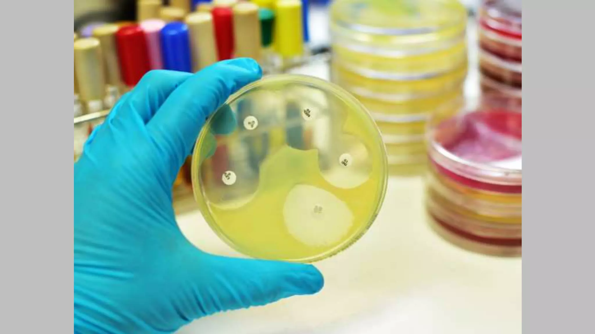 URINE CULTURE SPECIMEN.pptx