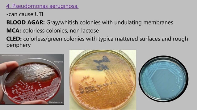 URINE CULTURE SPECIMEN.pptx