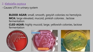 URINE CULTURE SPECIMEN.pptx