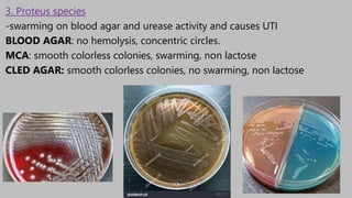 URINE CULTURE SPECIMEN.pptx