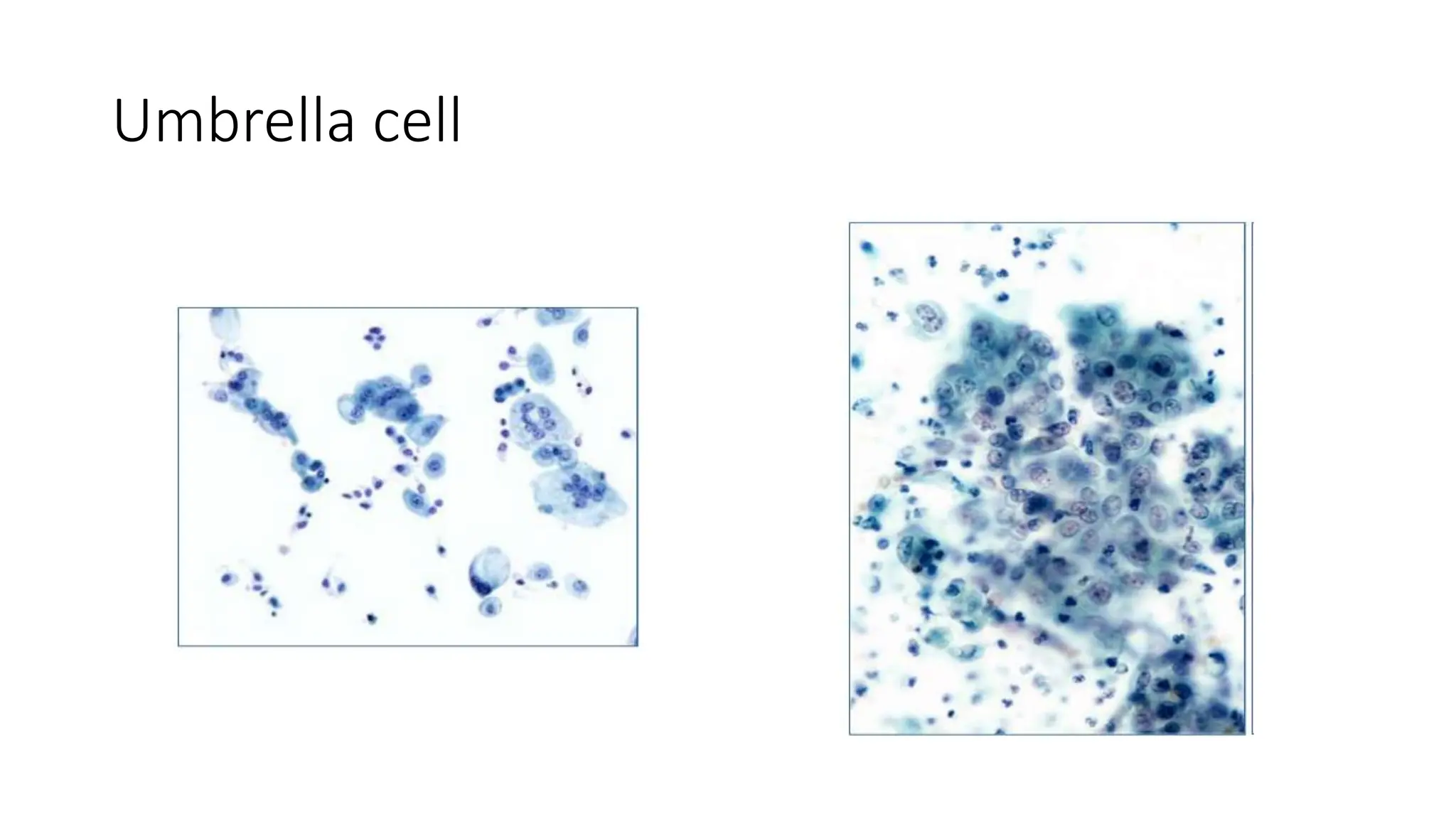 Urine cytology - Diagnostic Principles and Reporting.pptx