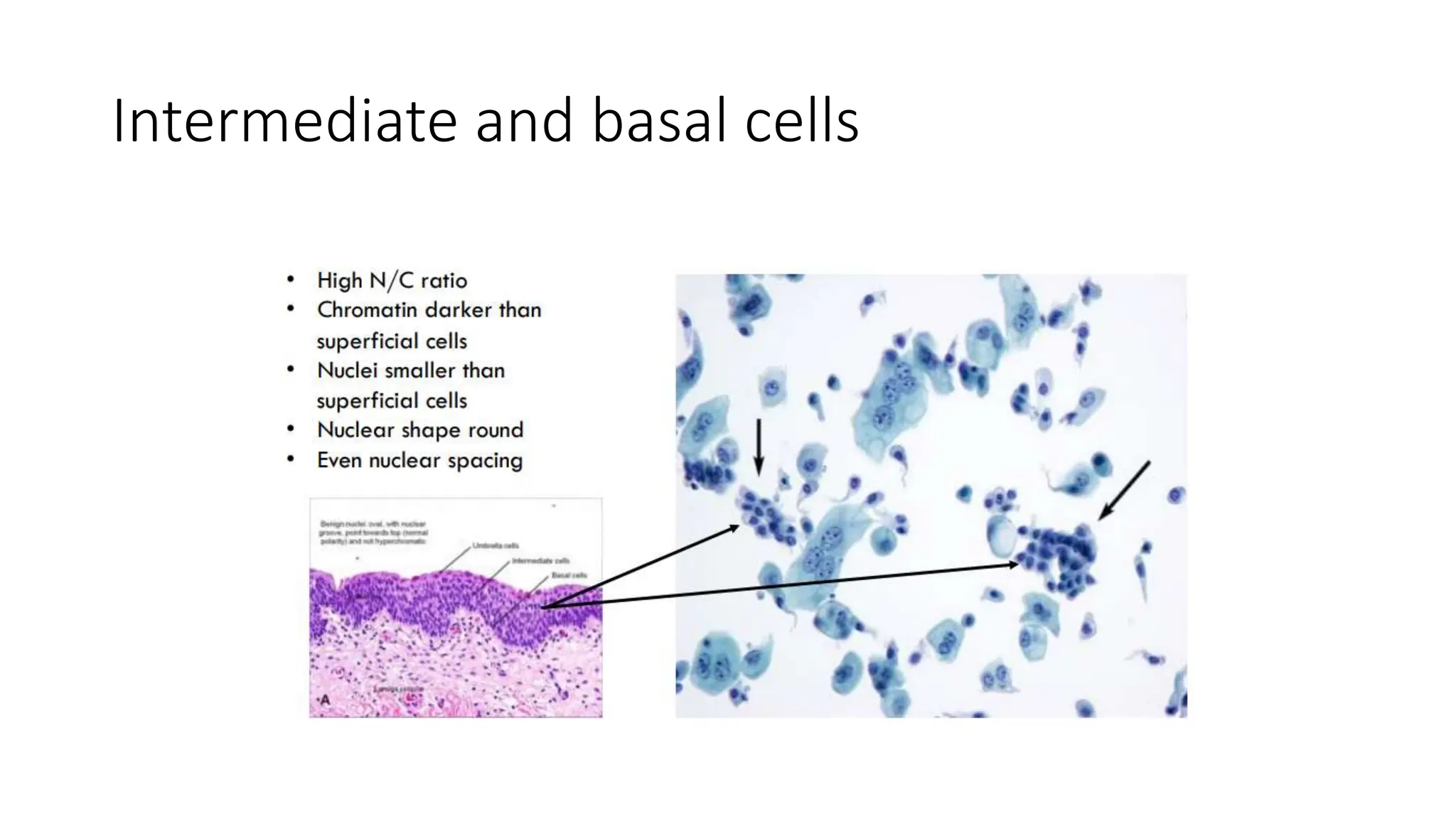 Urine cytology - Diagnostic Principles and Reporting.pptx