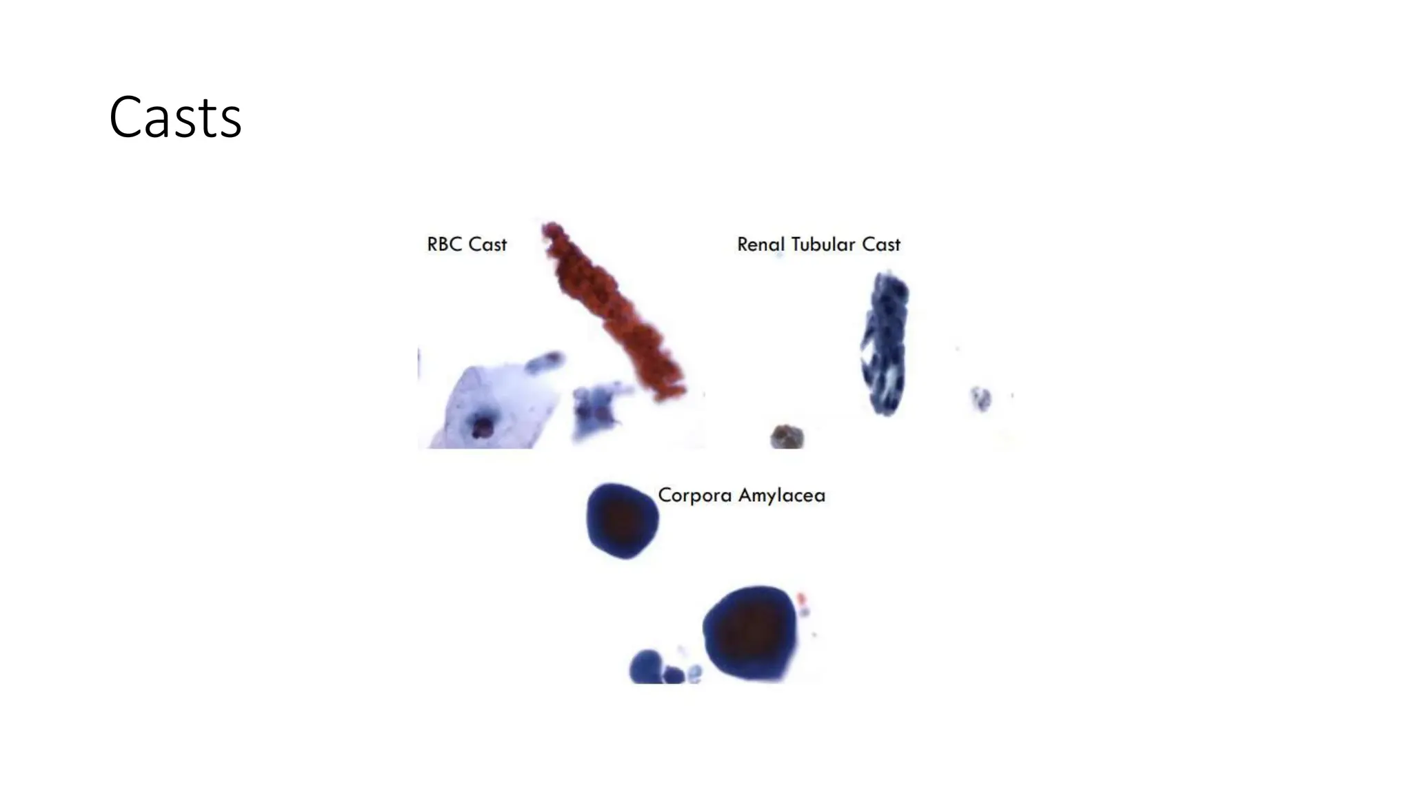Urine cytology - Diagnostic Principles and Reporting.pptx