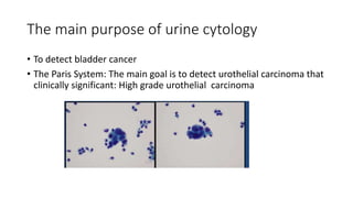 Urine cytology - Diagnostic Principles and Reporting.pptx