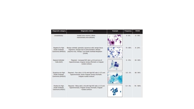Urine cytology - Diagnostic Principles and Reporting.pptx