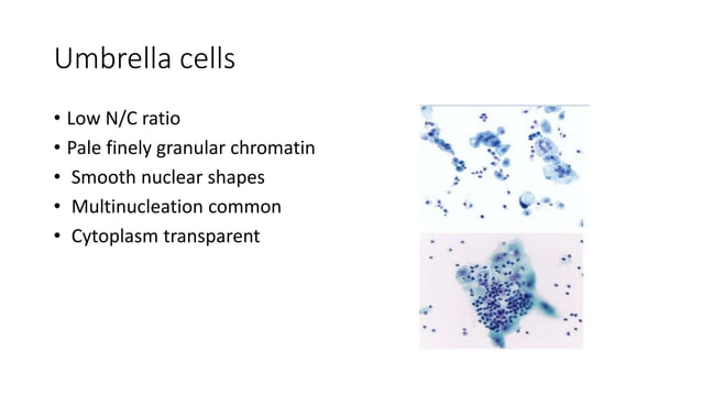 Urine cytology - Diagnostic Principles and Reporting.pptx
