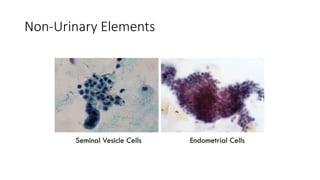 Urine cytology - Diagnostic Principles and Reporting.pptx
