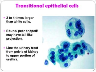 Urine examination | PPTX