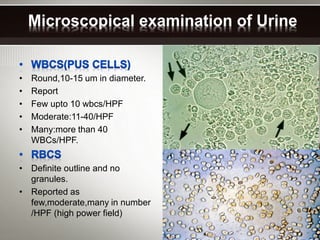 Urine examination | PPTX