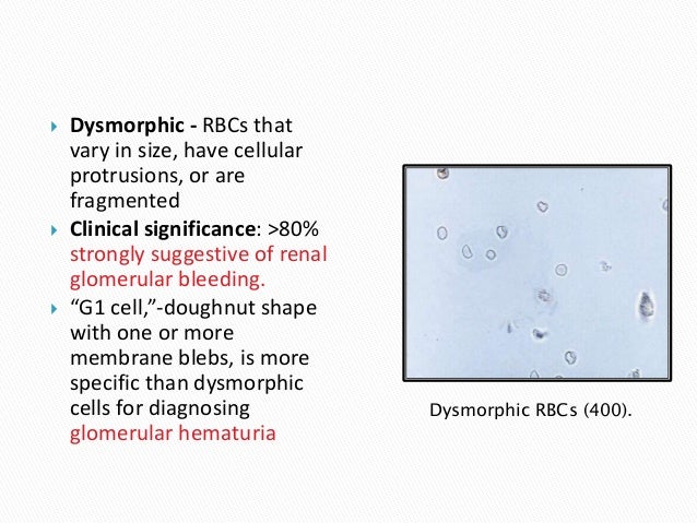 Leukocytes In Urine Test