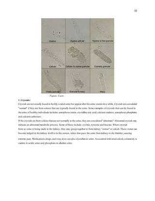Urine examination | DOCX | Chemistry | Science
