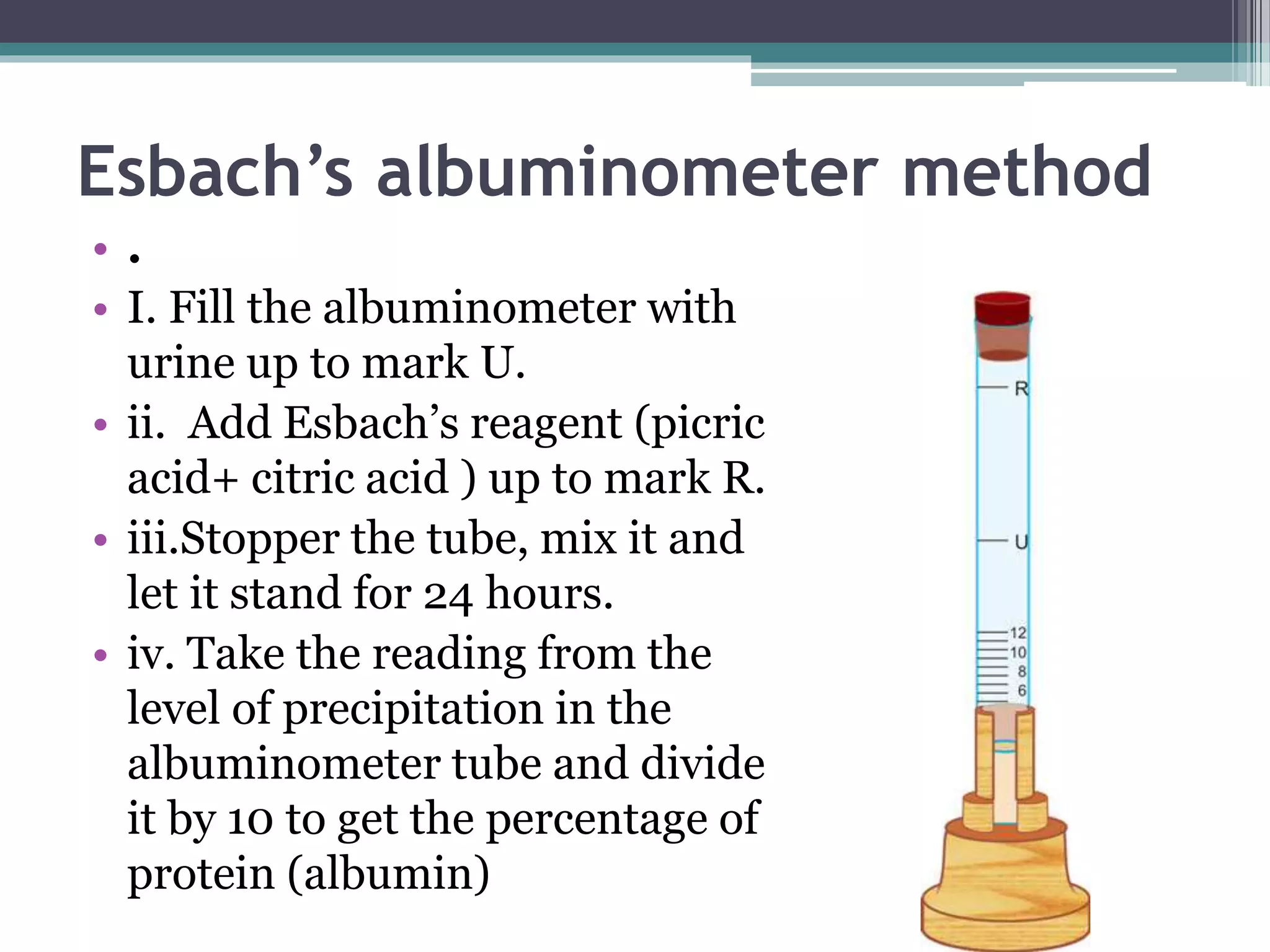 Urine examination , urine, chemical examination | PPTX