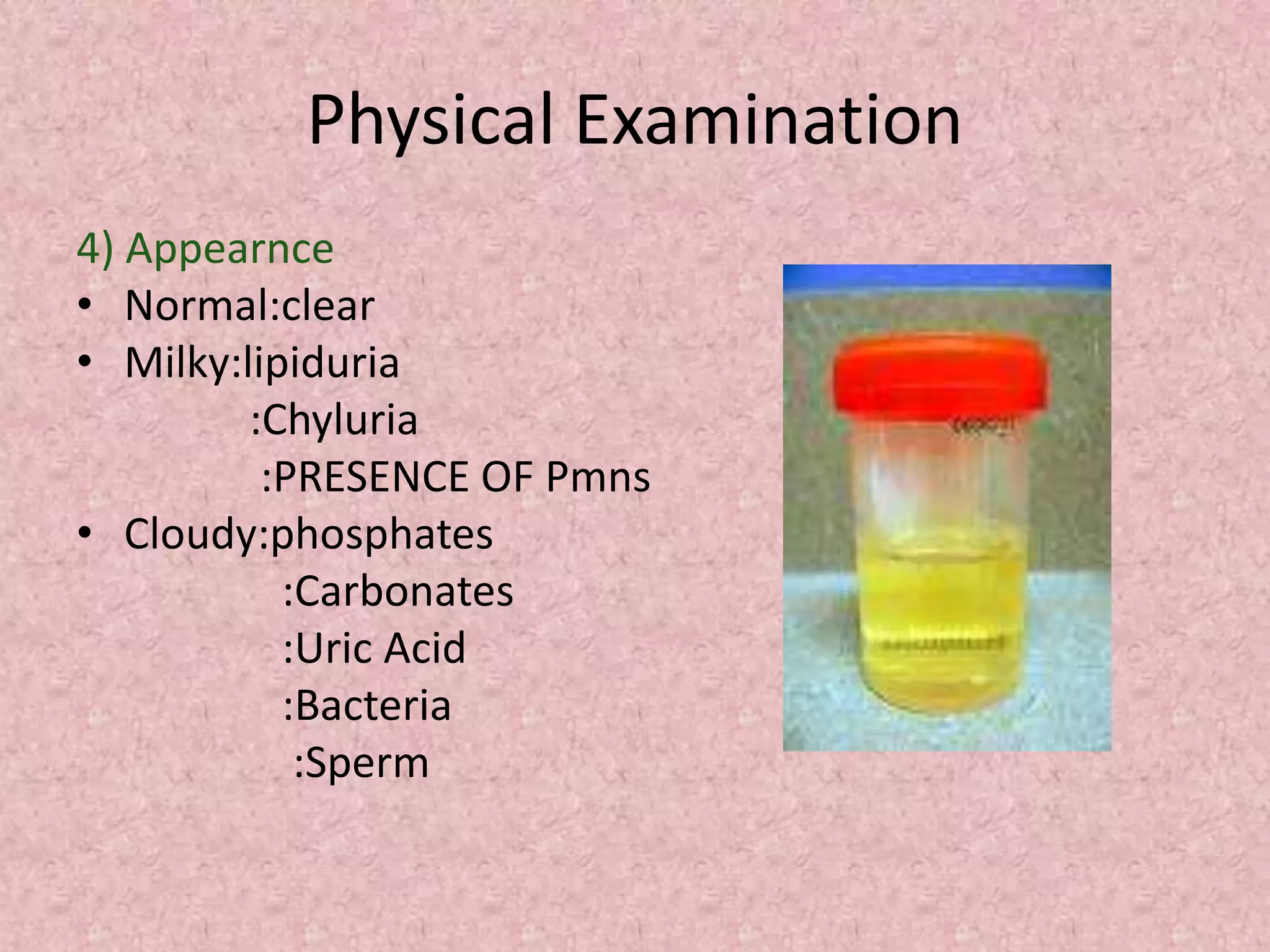 Urine examination | PPT