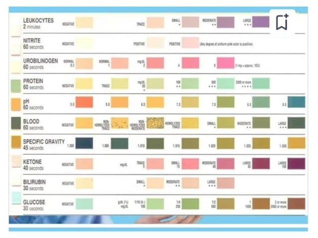 Urine examination/analysis in Pediatrics | PPT