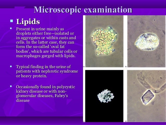 Urine examination how to approach final.ppt1