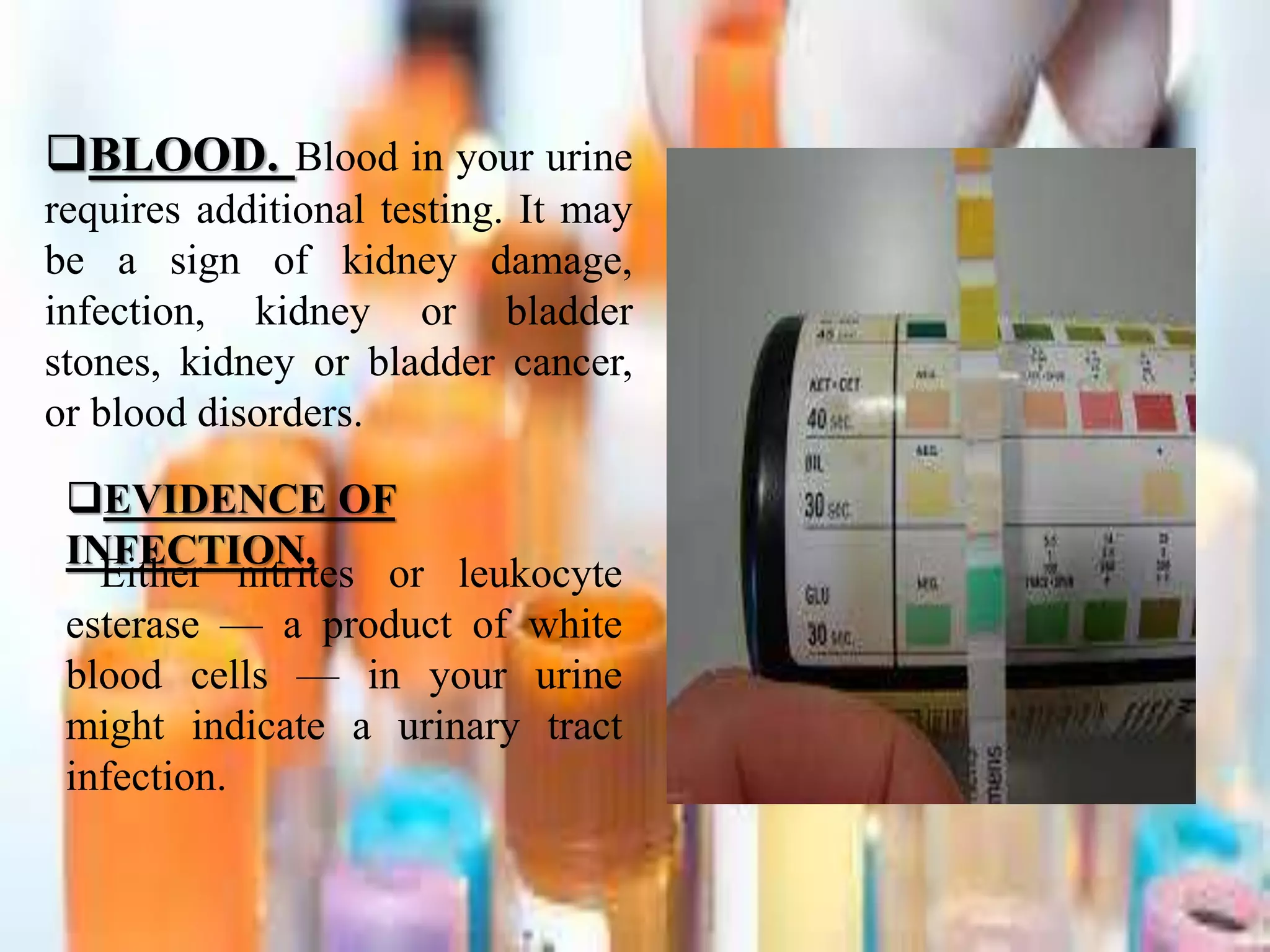 Urine Examination Overview 2 Pptx