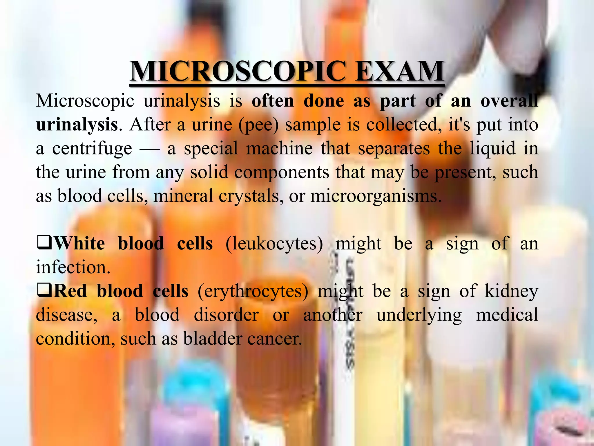 Urine Examination Overview 2 Pptx