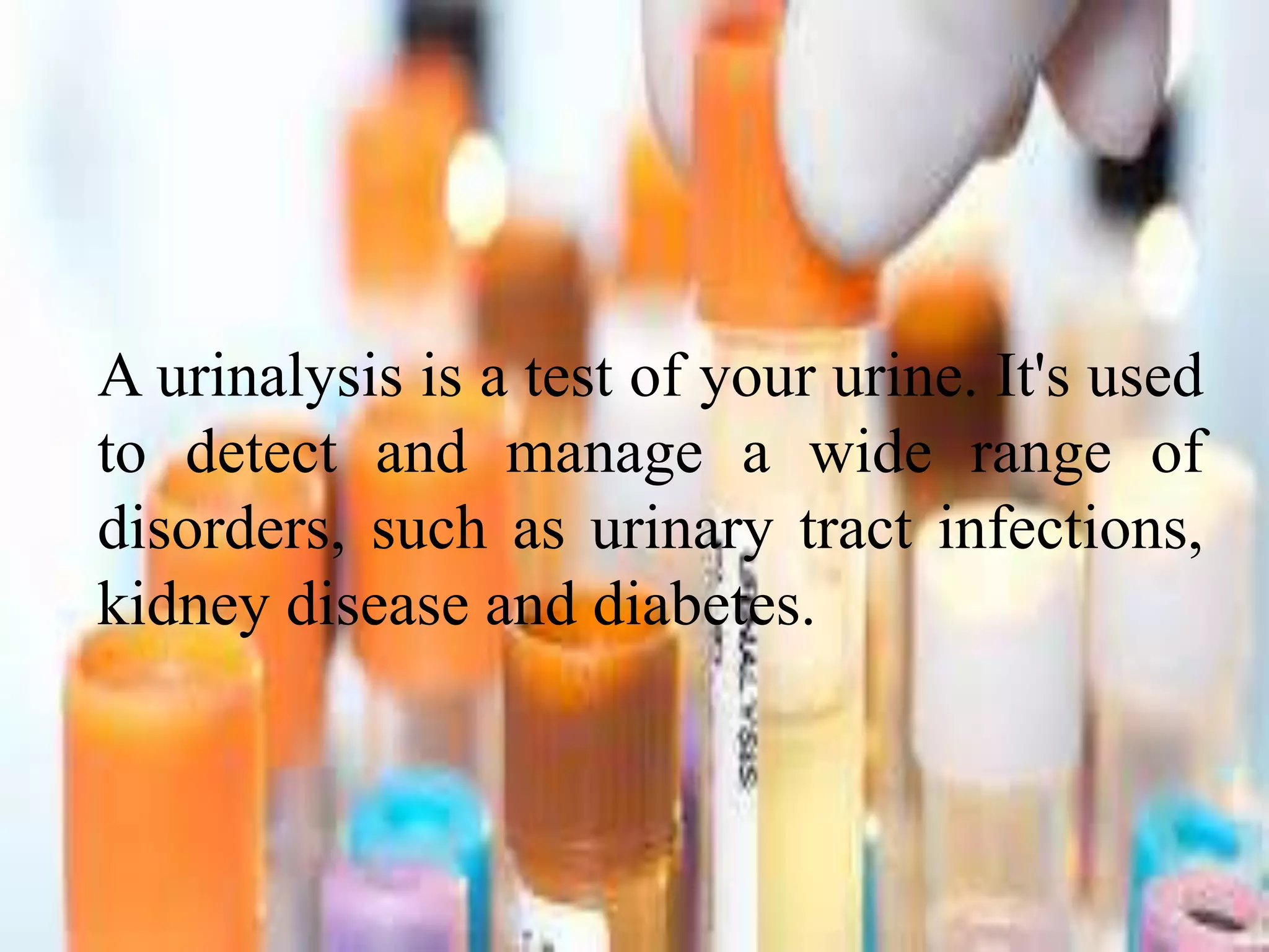 URINE EXAMINATION- overview (2).pptx