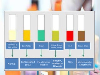 URINE EXAMINATION- overview (2).pptx