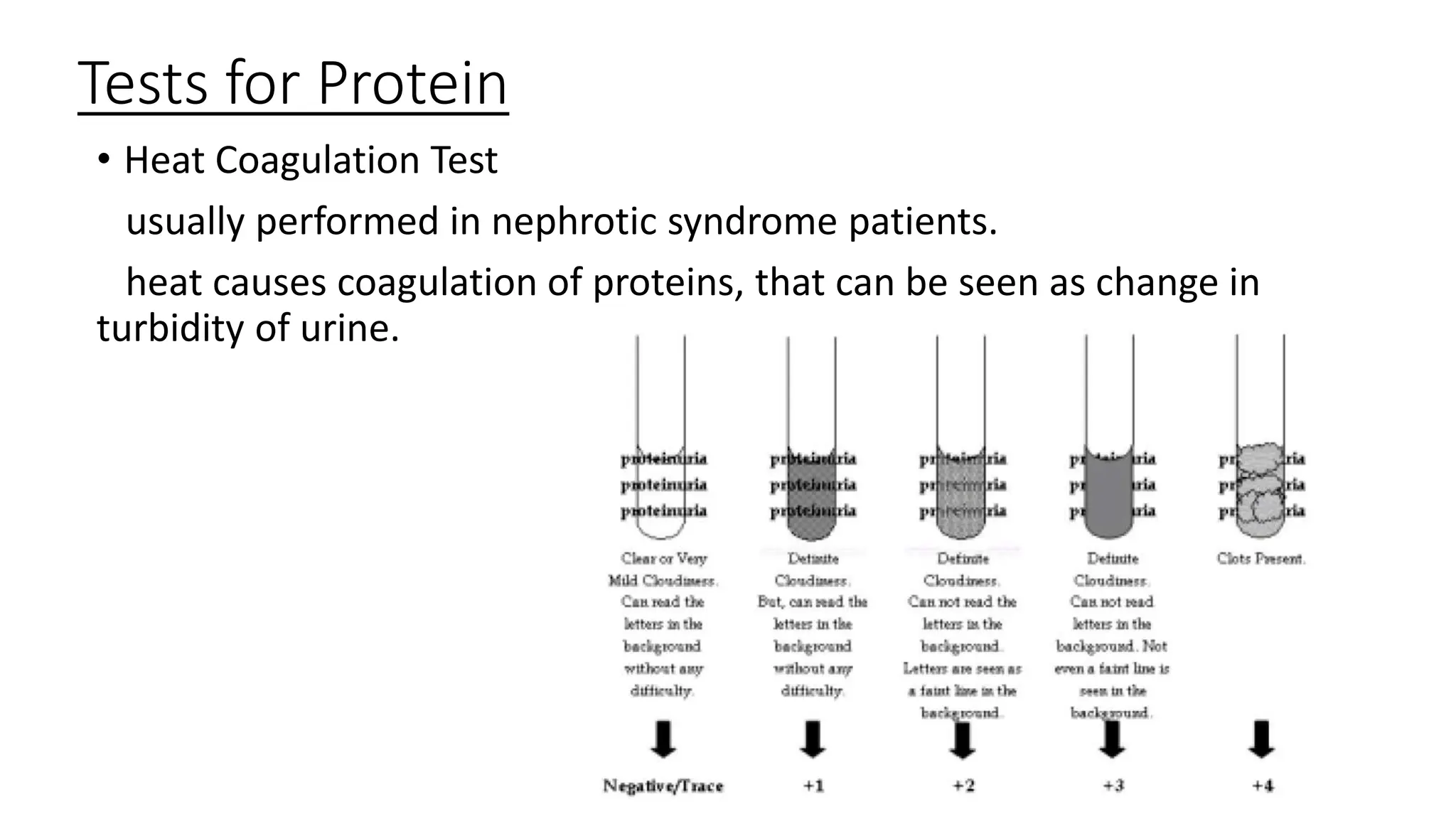 Urine Examination in paediatrics PPT.pptx