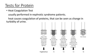 Urine Examination in paediatrics PPT.pptx