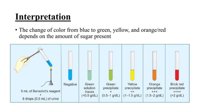 Examination of Urine - Biochemistry and Pathology for Science Students ...