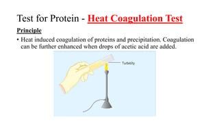 Examination of Urine - Biochemistry and Pathology for Science Students ...